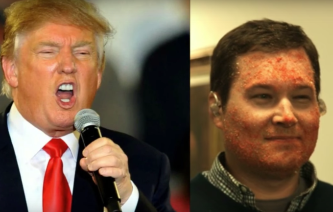 Glenn Beck Covers Face In Cheetos To Look Like Donald Trump Complex